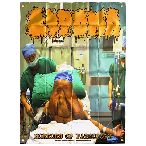 Lipoma Reality Fade Merch