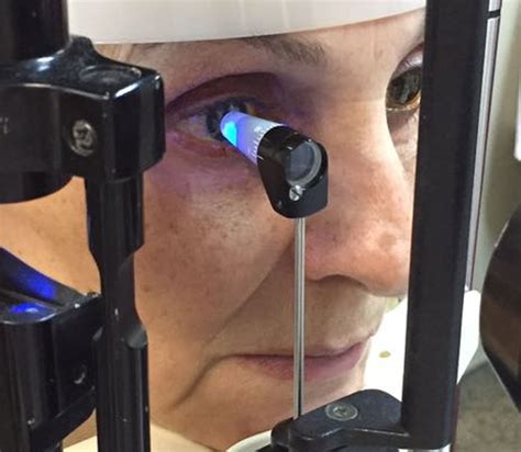 Glaucoma Information How Is Tonometry Done Glaucoma Information