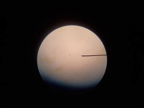Worm And Worm Eggs Microscope Pictures And A Treatment Tale