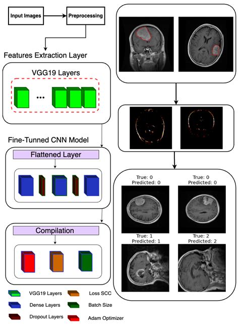 A Unified Pipeline For Simultaneous Brain Tumor Classification And Segmentation Using Fine Tuned