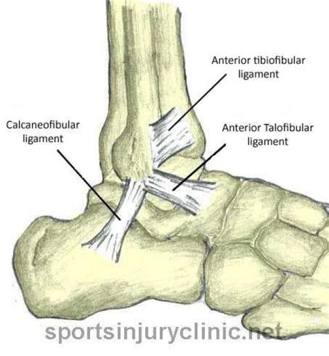What Is A Full Thickness Tear Of The Anterior Talofibular Ligament At