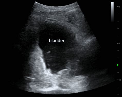 Cat Bladder Ultrasound At Alyssa Coode Blog