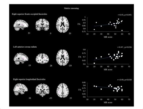 Figure Correlation Between Fa And Matrix Reasoning Scores In The Region Download Scientific