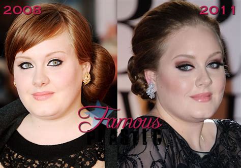 Adele Plastic Surgery Nose Job Before And After Star Plastic Surgery