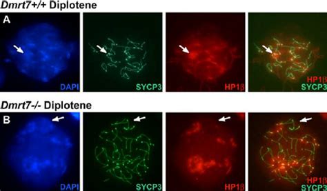 Abnormal Sex Chromatin In Cells Staged By Chromosome Pairing Status A Download Scientific