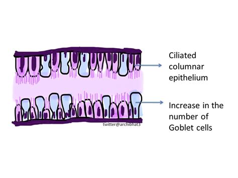 Chronic Bronchitis Pathology