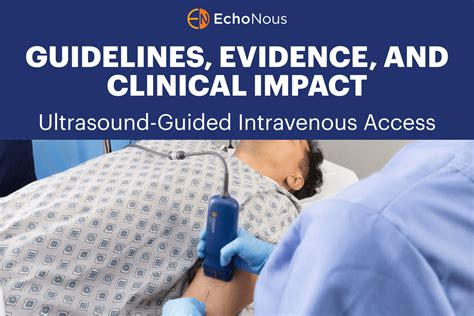 Ultrasound Guided Iv Access Rationale Echonous