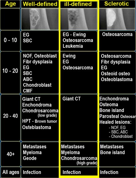 Bone Lesions Bone Lesions