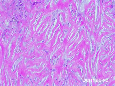 Dermapixel Octubre 2022