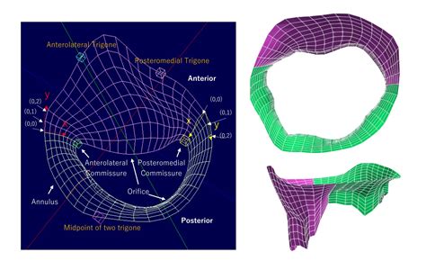 Preclinical Validation Of Automatic Mitral Valve Segmentation And Measurement Technology For