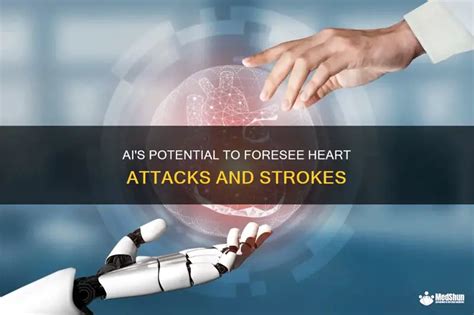 Ais Potential To Foresee Heart Attacks And Strokes Medshun