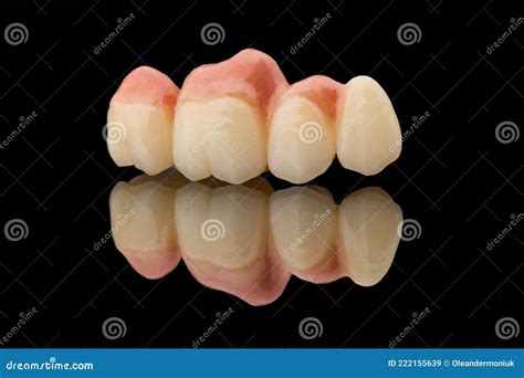 Dental Bridge Of 4 Teeth On Artificial Gums Close Up Photo Of Ceramic Teeth Crown Isolated On
