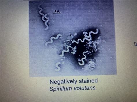 Solved 박 Negatively Stained Spirillum Volutans Name Date