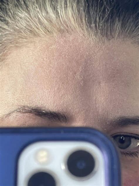 Why Does My Makeup Pill My Glow Journey