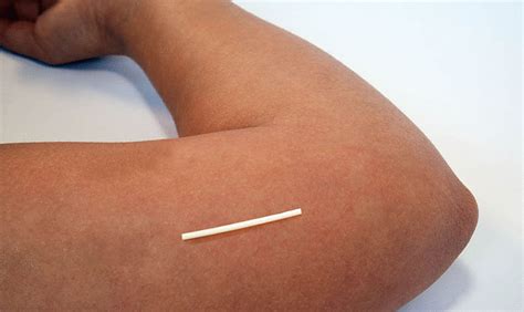 Contraceptive Implants