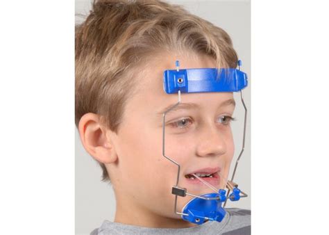 Headgear Braces