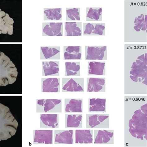 Overall Workflow Of The 3d Volume Histology Image Reconstruction Of The