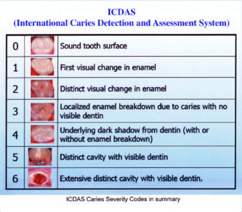 Ohp Lec 3 Dental Caries I The Caries Process Flashcards Quizlet