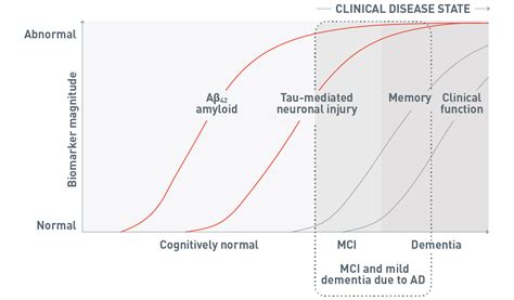 Alzheimers Disease Chart