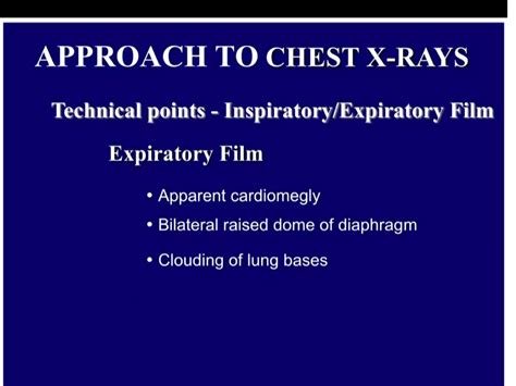 Chest X Ray Interpretation Pdf