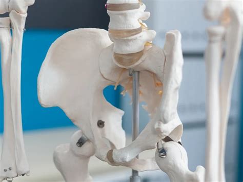 Hip Calcification Op Dr Özgür Oktay Nar