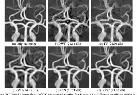 structural group sparse representation for image compressive sensing