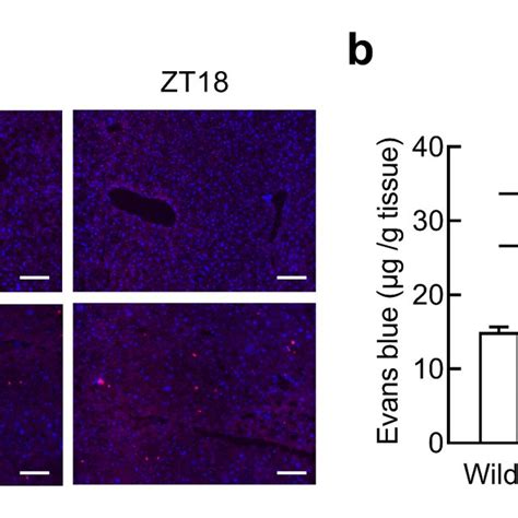diurnal expression of hepatic tight junction related gene in ob ob