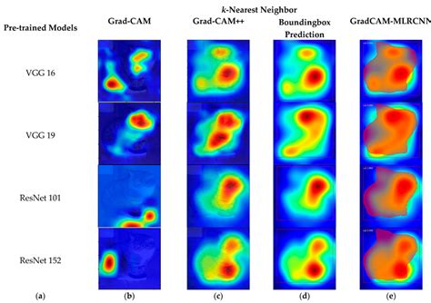 A Various Pre Trained Models B Results Of Grad CAM C Results Of Download Scientific