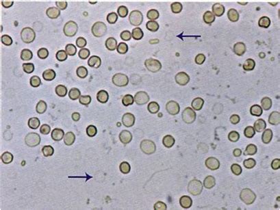 MEDT Microscopy Flashcards Quizlet