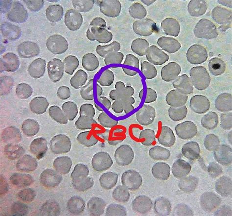 How Will You Explain The Shape Of This Red Cell ResearchGate