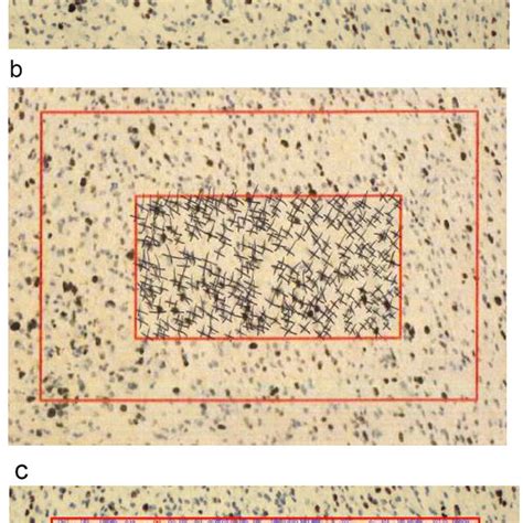 Comparison Of Positive Of Manual Count Vs Automated Qupath Count