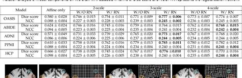 Table 3 From Learning Deformable Image Registration From Optimization Perspective Modules