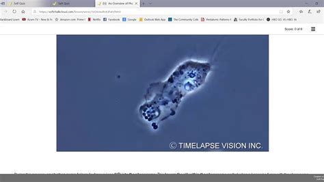 Overview Of Phagocytosis The Complement Pathways And Antibacterial Peptides Youtube