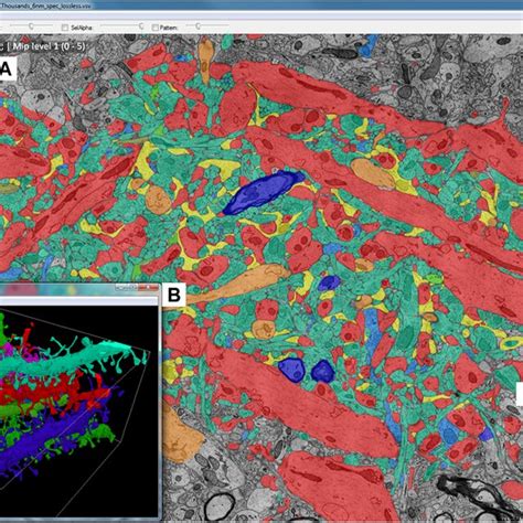 The Volume Annotation And Segmentation Tool Vast User Interface The Download Scientific