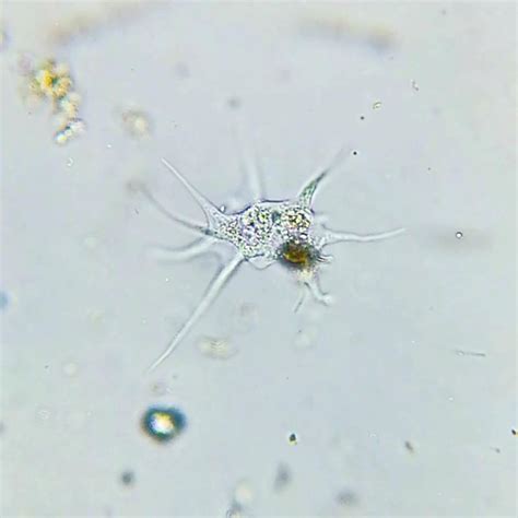 Meet My First Amoeba I Found Of Them In The Same Drop Microscopy Microscope Biology