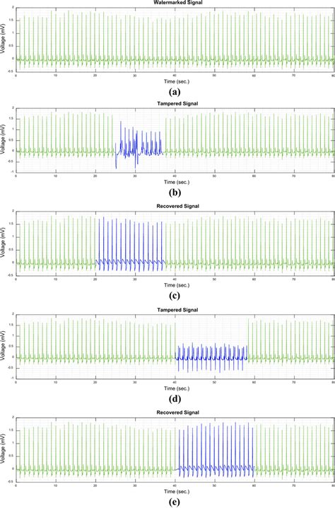 Copy Paste Tampering A Watermarked Ecg Signal B 10 Tampering C