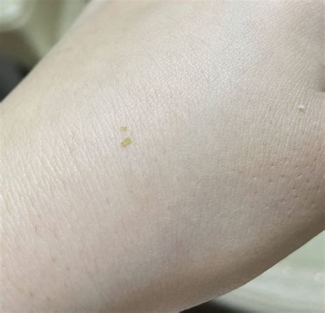 이정도 피지는 큰건가 혐오주의 인스티즈 Instiz 일상 카테고리