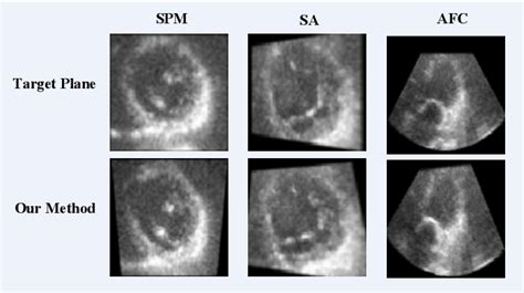 Figure 6 From Towards Autonomous Robotic Ultrasound Scanning Using The Reinforcement Learning