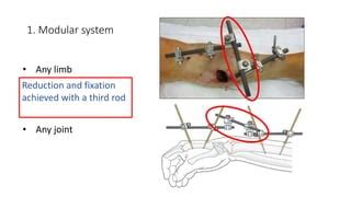 Principles Of External Fixationpptx