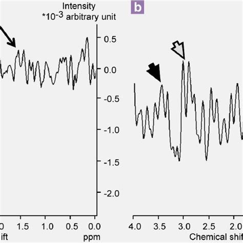 Magnetic Resonance MR Spectroscopy The MR Spectrum Shows Peaks For Download Scientific