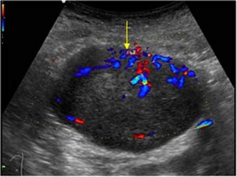 Urinary Tract And Male Reproductive System 2 1 Kidney And Ureter