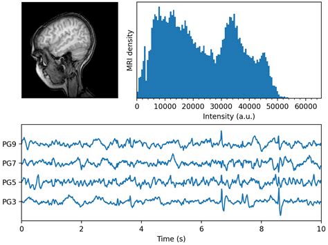mri with eeg — matplotlib 3 10 1 documentation
