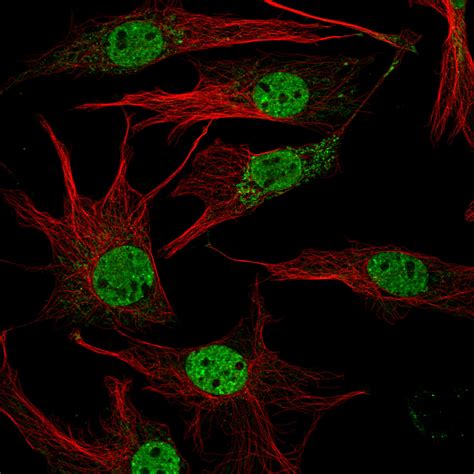 Subcellular Mrtfb The Human Protein Atlas