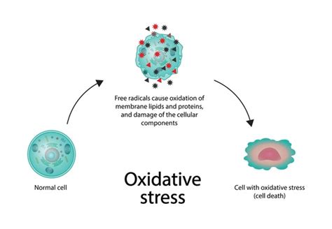 61 Chronic Diseases Oxidative Stress Stock Vectors And Vector Art