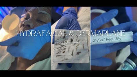 Zo Hydrafacial And Dermaplane Youtube