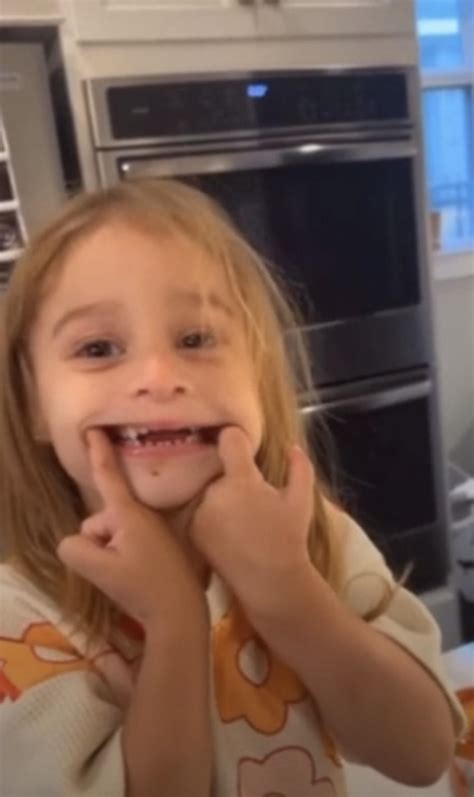 This Is Her Poor Bite Her Top And Bottom Teeth In The Back Are