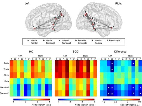 Upper Panel The Intrinsic Functional Connectivity Of Default Mode Download Scientific Diagram