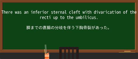 【英単語】divaricationを徹底解説！意味、使い方、例文、読み方 おもしろい英文法