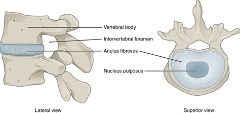 Annular Tear Pain In The Back Allspine