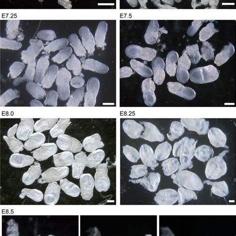 A Single Cell Molecular Map Of Mouse Gastrulation And Early
